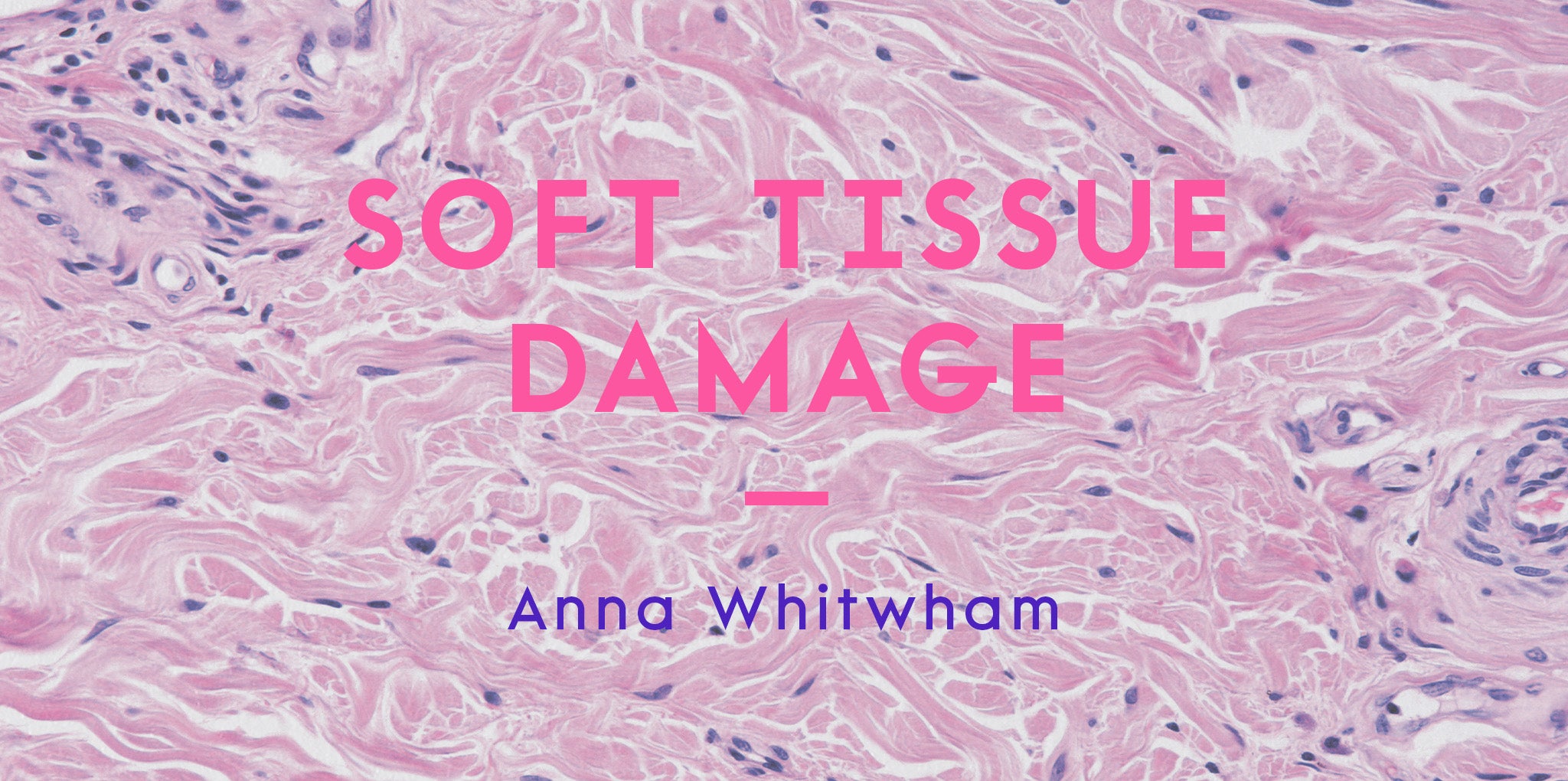 Soft Tissue Damage (SIGNED COPIES) - Anna Whitwham – Rough Trade Books